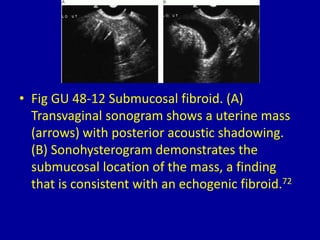 48 the endometrium | PPTX