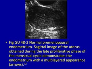 48 the endometrium | PPTX