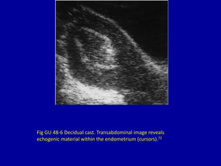 48 the endometrium | PPTX