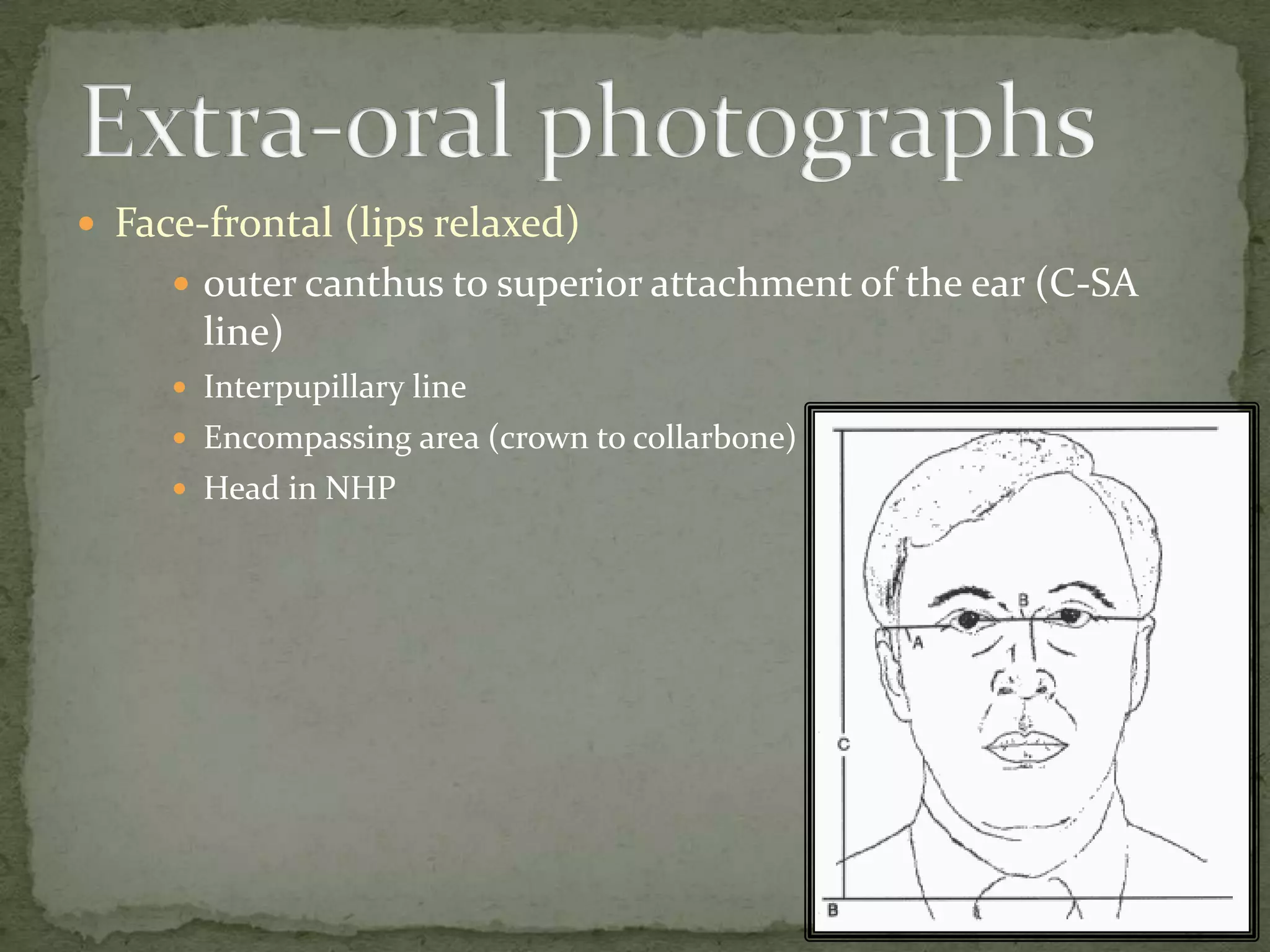 Clinical photography in dentistry | PPTX