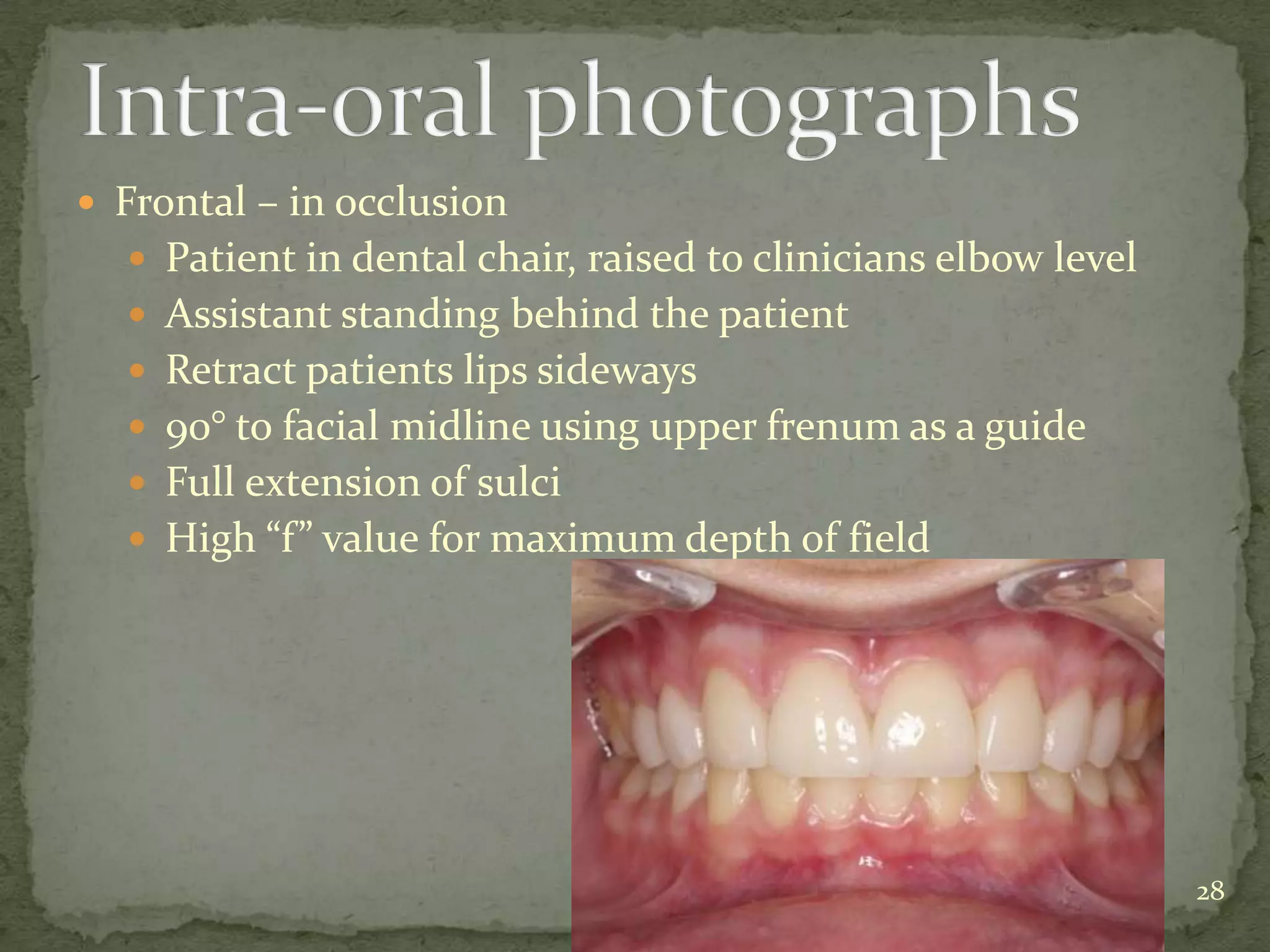 Clinical photography in dentistry | PPTX