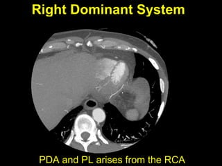 Imaging of Coronary artery disease slideshow.pdf