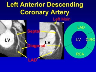 Imaging of Coronary artery disease slideshow.pdf