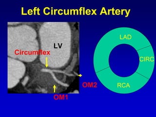 Imaging of Coronary artery disease slideshow.pdf