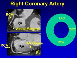 Imaging of Coronary artery disease slideshow.pdf