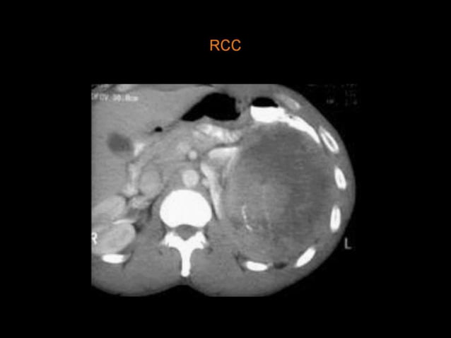 49 Dr Ahmed Esawy imaging oral board of urinary tract part I | PPT