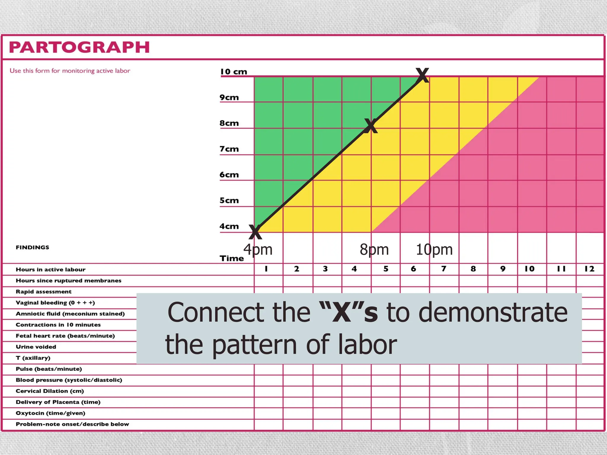 490170509-PARTOGRAPH.pdf lecture to the students | PDF