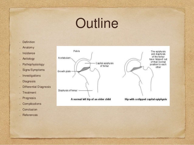 SUFE presentation to upload 2