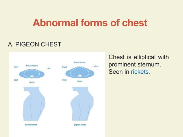 498485741-Respiratory-System-Examination.pptx