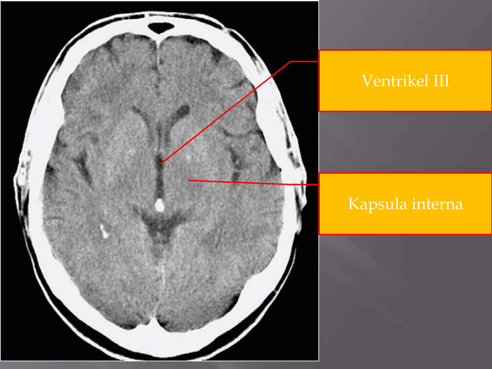 4a. Bimbingan Neuroimaging CT Scan Kepala - Residen.pptx