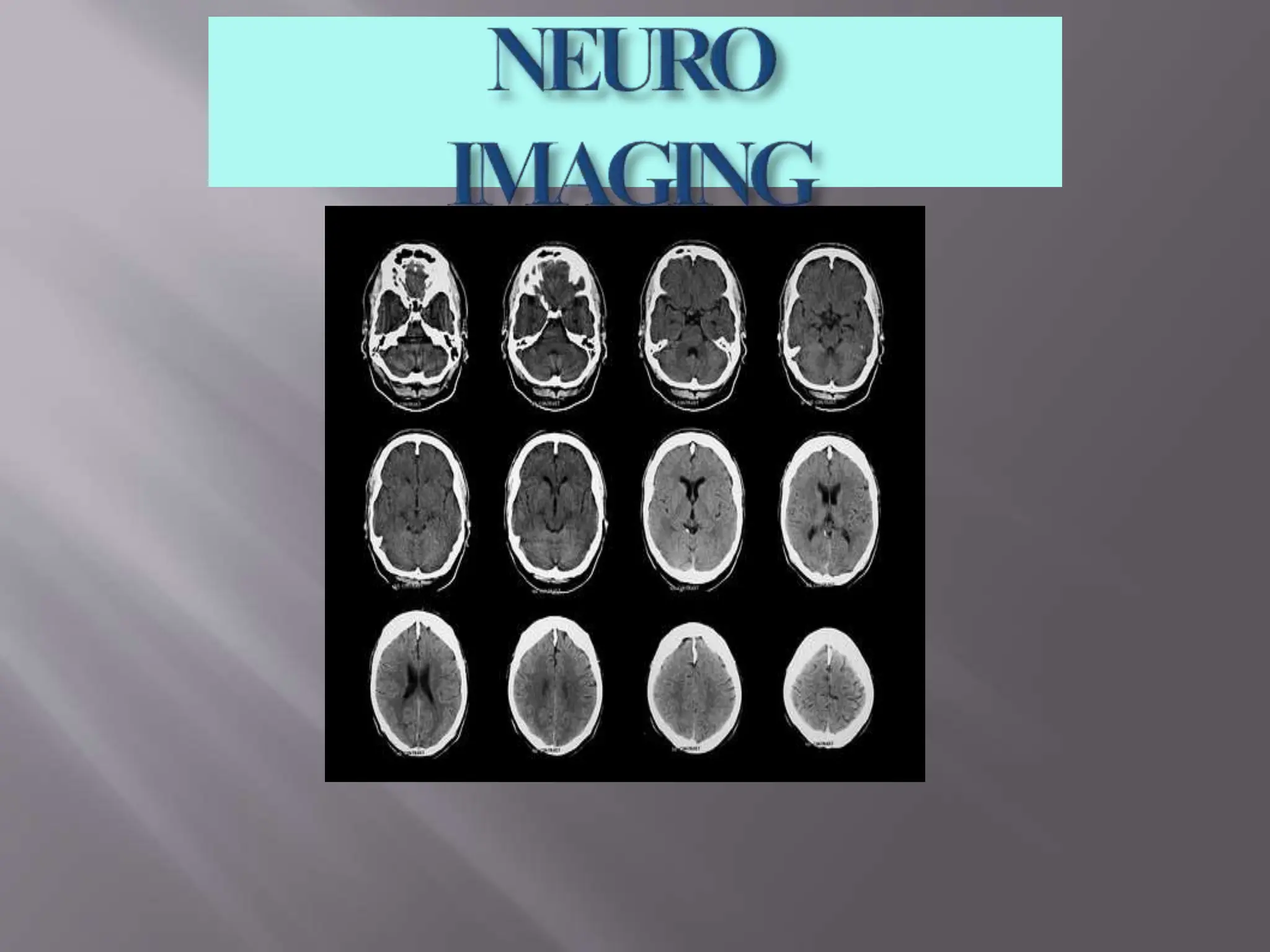 4a. Bimbingan Neuroimaging CT Scan Kepala - Residen.pptx