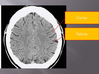 4a. Bimbingan Neuroimaging CT Scan Kepala - Residen.pptx