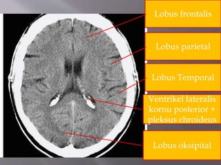 4a. Bimbingan Neuroimaging CT Scan Kepala - Residen.pptx