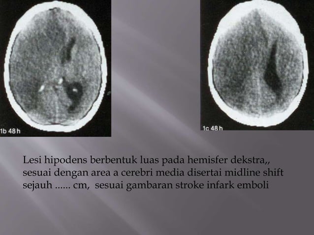 4a. Bimbingan Neuroimaging CT Scan Kepala - Residen.pptx