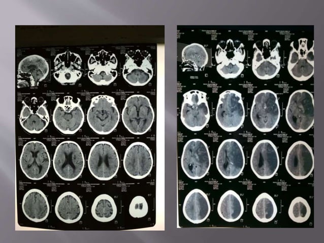 4a. Bimbingan Neuroimaging CT Scan Kepala - Residen.pptx