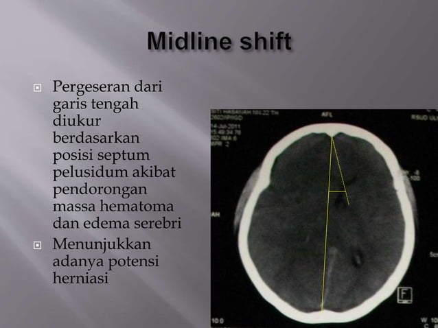 4a. Bimbingan Neuroimaging CT Scan Kepala - Residen.pptx