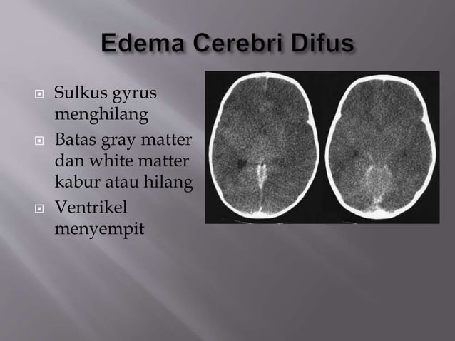 4a. Bimbingan Neuroimaging CT Scan Kepala - Residen.pptx