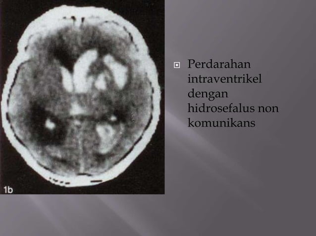 4a. Bimbingan Neuroimaging CT Scan Kepala - Residen.pptx