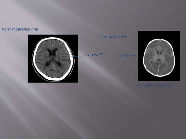 4a. Bimbingan Neuroimaging CT Scan Kepala - Residen.pptx