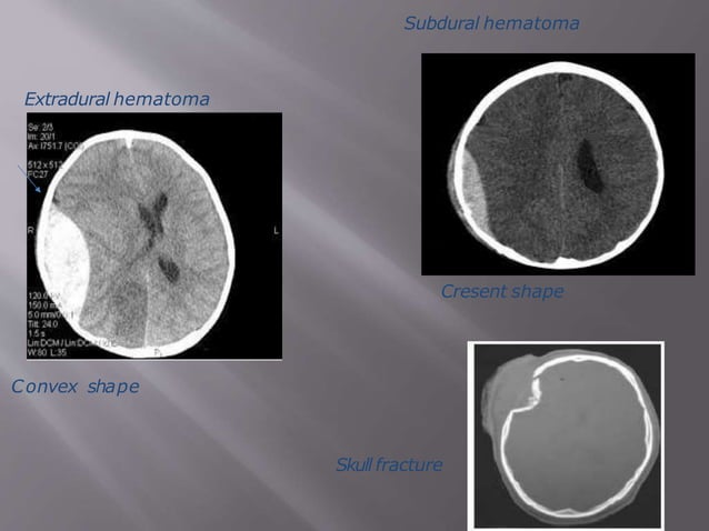 4a. Bimbingan Neuroimaging CT Scan Kepala - Residen.pptx