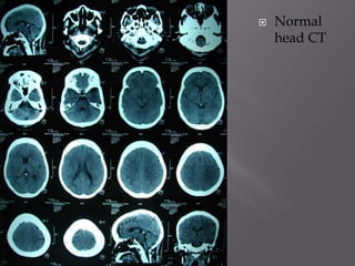 4a. Bimbingan Neuroimaging CT Scan Kepala - Residen.pptx