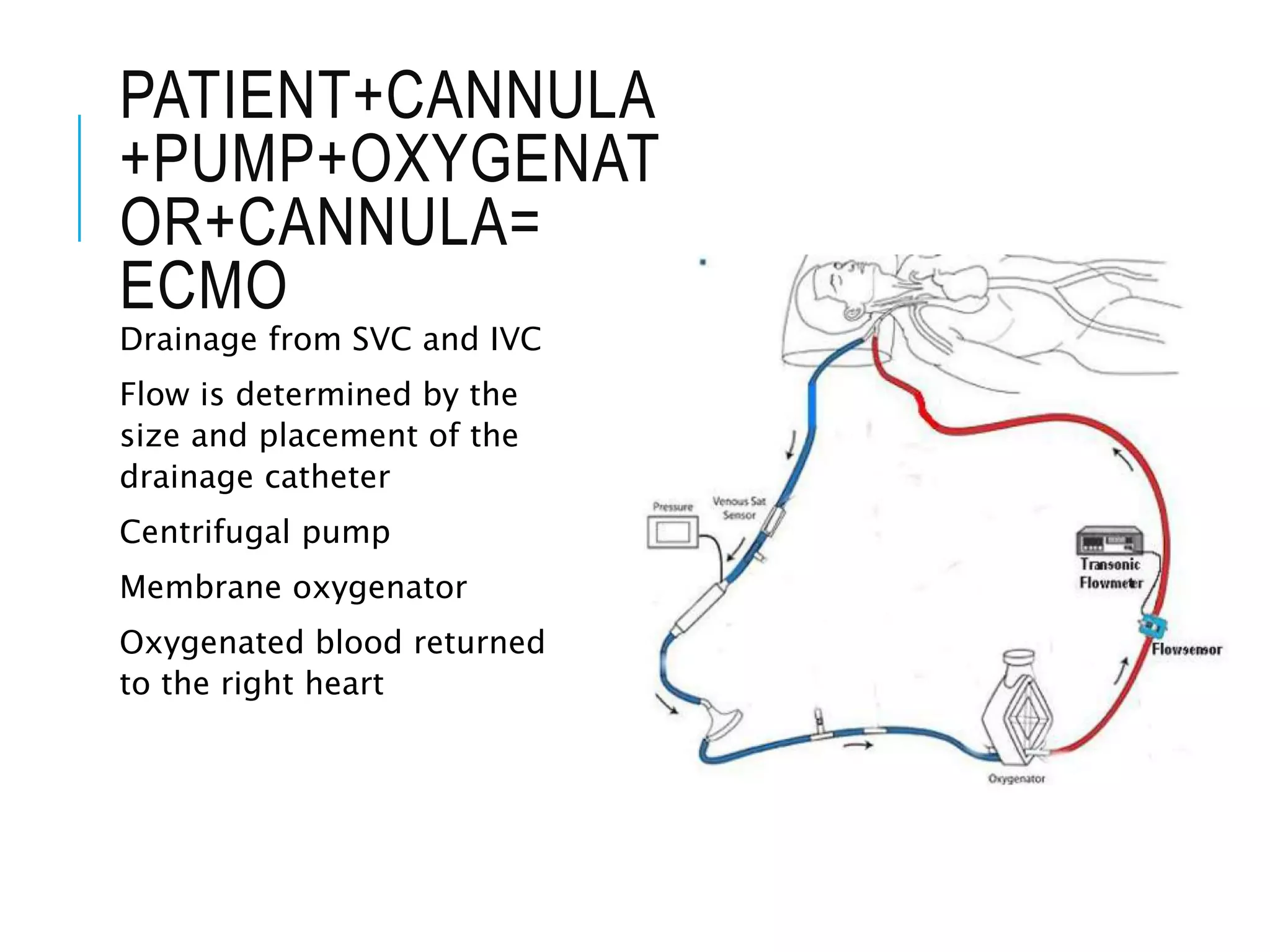 ECMO in Severe Respiratory Failure | PPTX