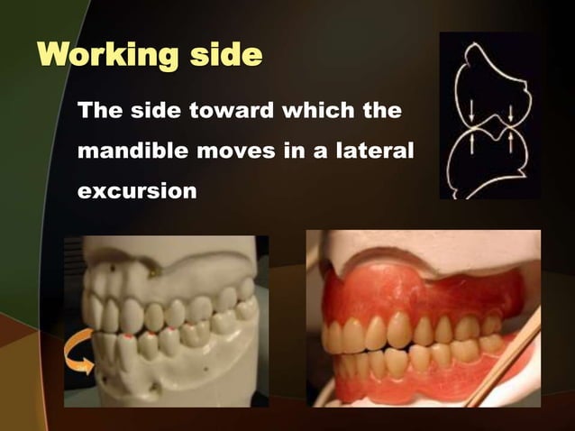 4 a - Introduction - jaw relation | PPT