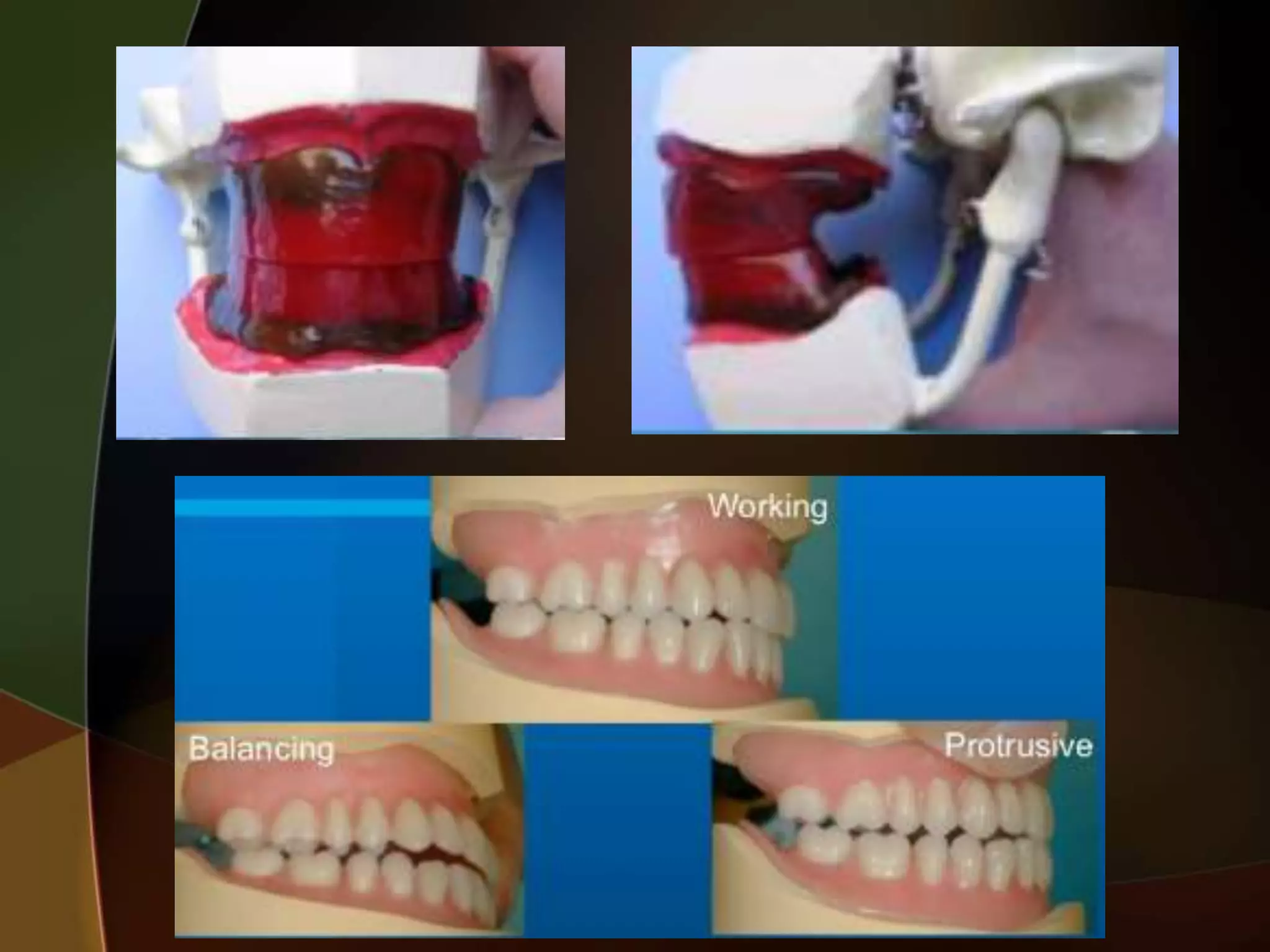 Jaw Relation Record - introduction jaw relation | PPT