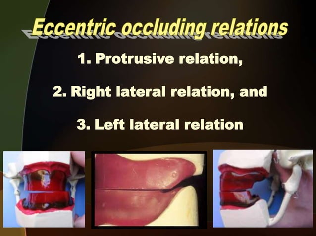 Jaw Relation Record - introduction jaw relation | PPT