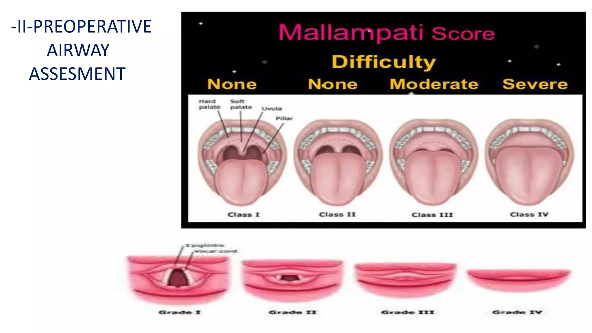airway assessment part-1-Anesthesia | PDF