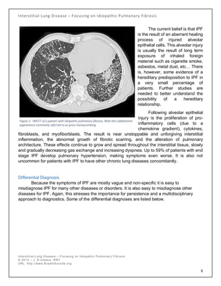 Interstitial Lung Disease - Focusing on Idiopathic Pulmonary Fibrosis | PDF