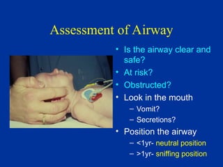 4 Airway, Breathing and Circulation paeds.ppt