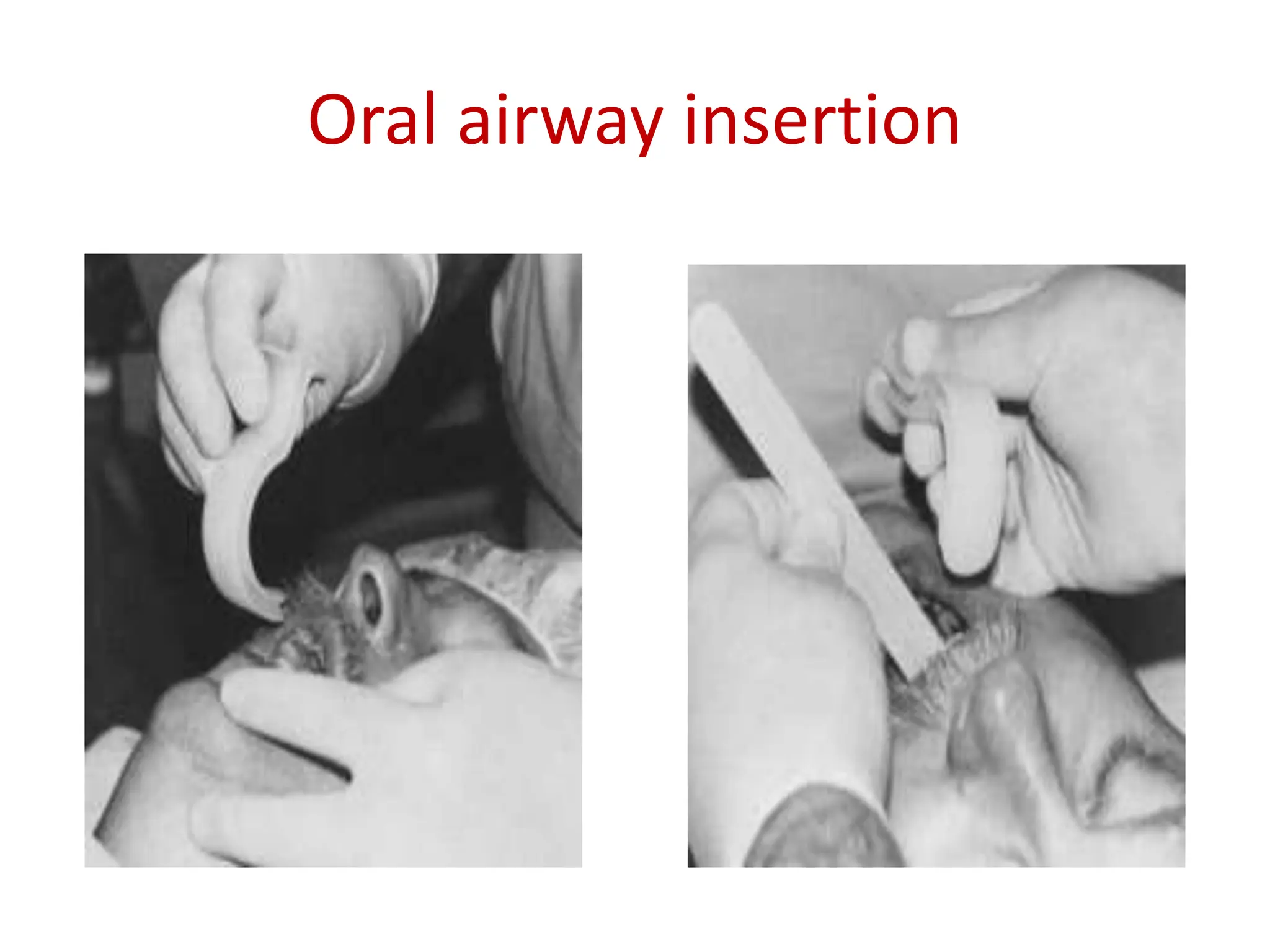 4 Airway management andOxygen delivery interfaces.pptx