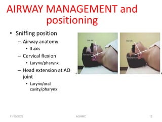 4 Airway management andOxygen delivery interfaces.pptx