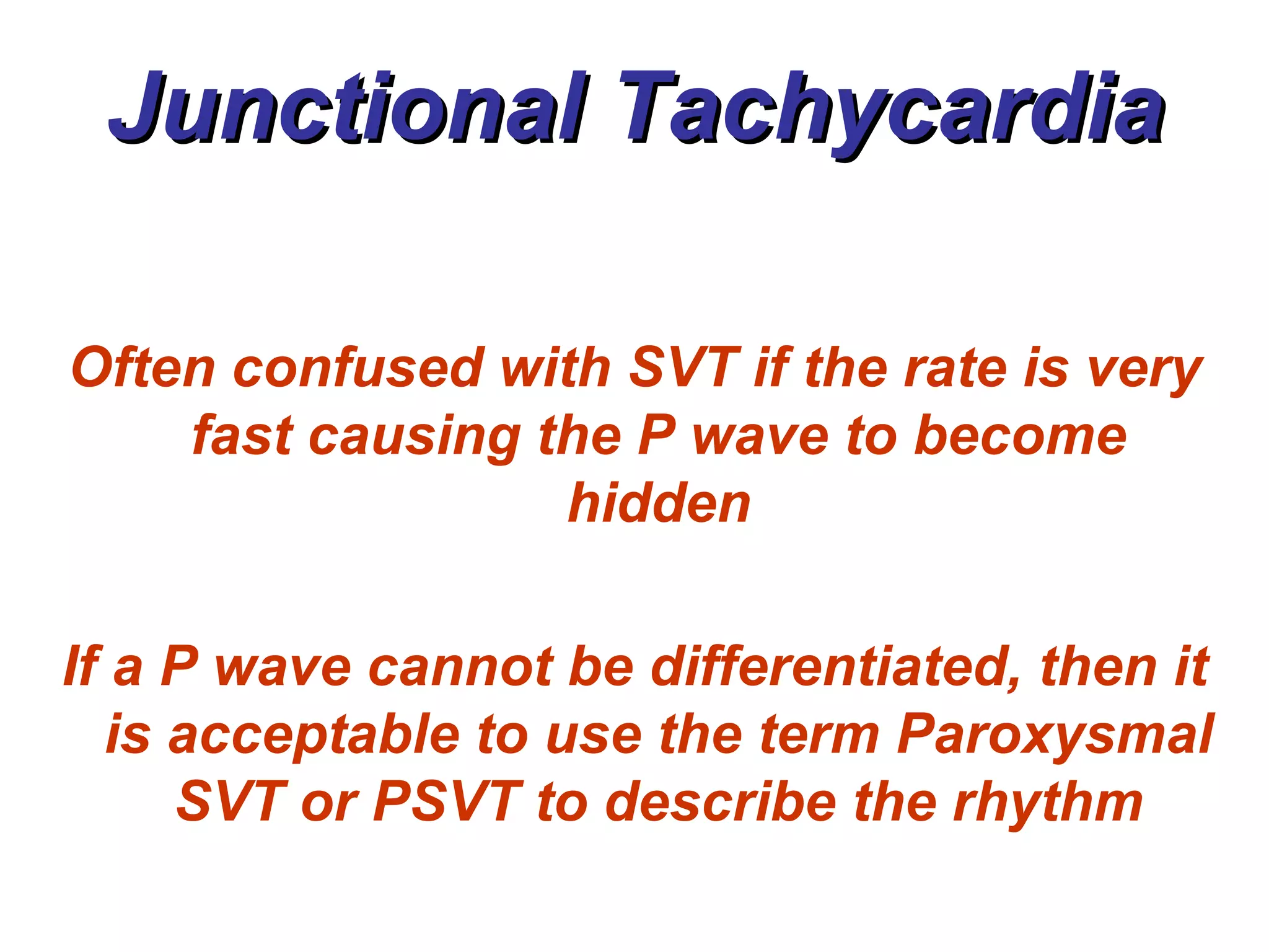Junctional Rhythms - BMH/Tele | PPT