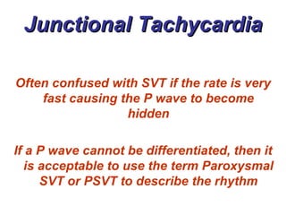 Junctional Rhythms - BMH/Tele | PPT