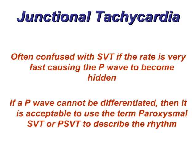 Junctional Rhythms - BMH/Tele | PPT | Heart and Cardiovascular Diseases ...