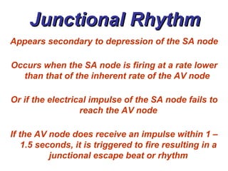 Junctional Rhythms - BMH/Tele | PPT