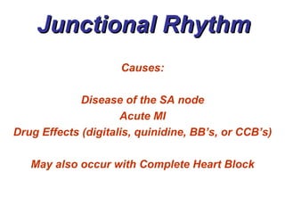Junctional Rhythms - BMH/Tele | PPT