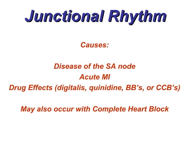 Junctional Rhythms - BMH/Tele | PPT | Heart and Cardiovascular Diseases ...