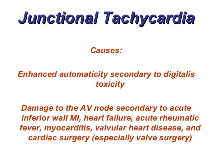 Junctional Rhythms - BMH/Tele