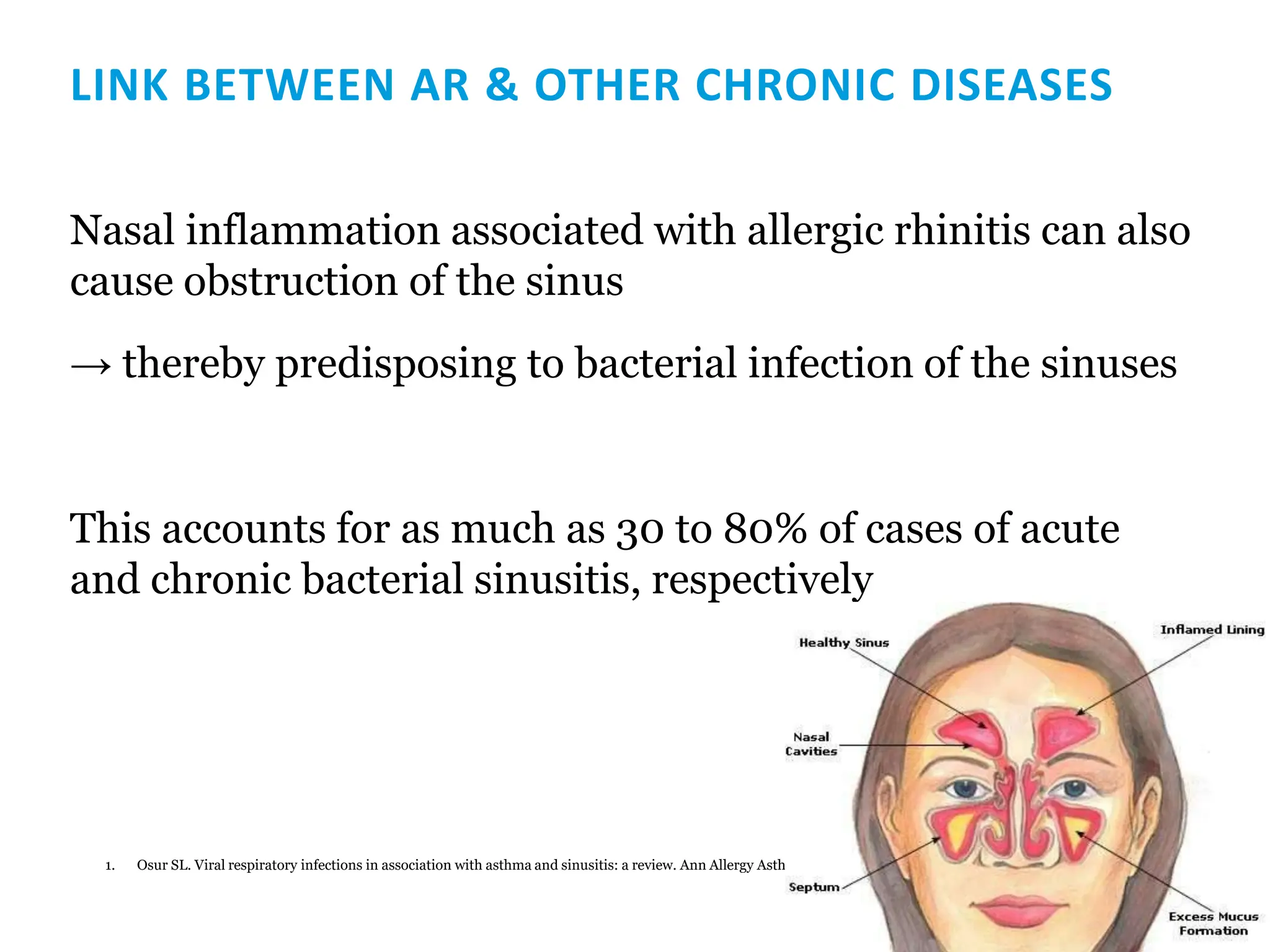 4 Allergic Rhinitis & URTI Allergic rhinitis – definition Burden and ...