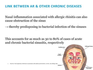 4 Allergic Rhinitis & URTI Allergic rhinitis – definition Burden and ...