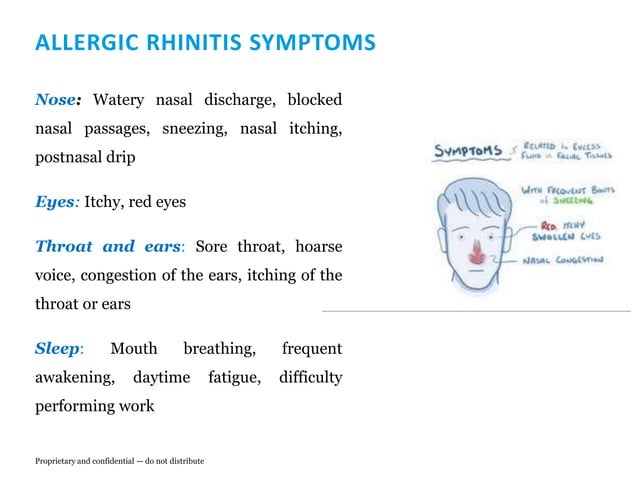 4 Allergic Rhinitis & URTI Allergic rhinitis – definition Burden and ...