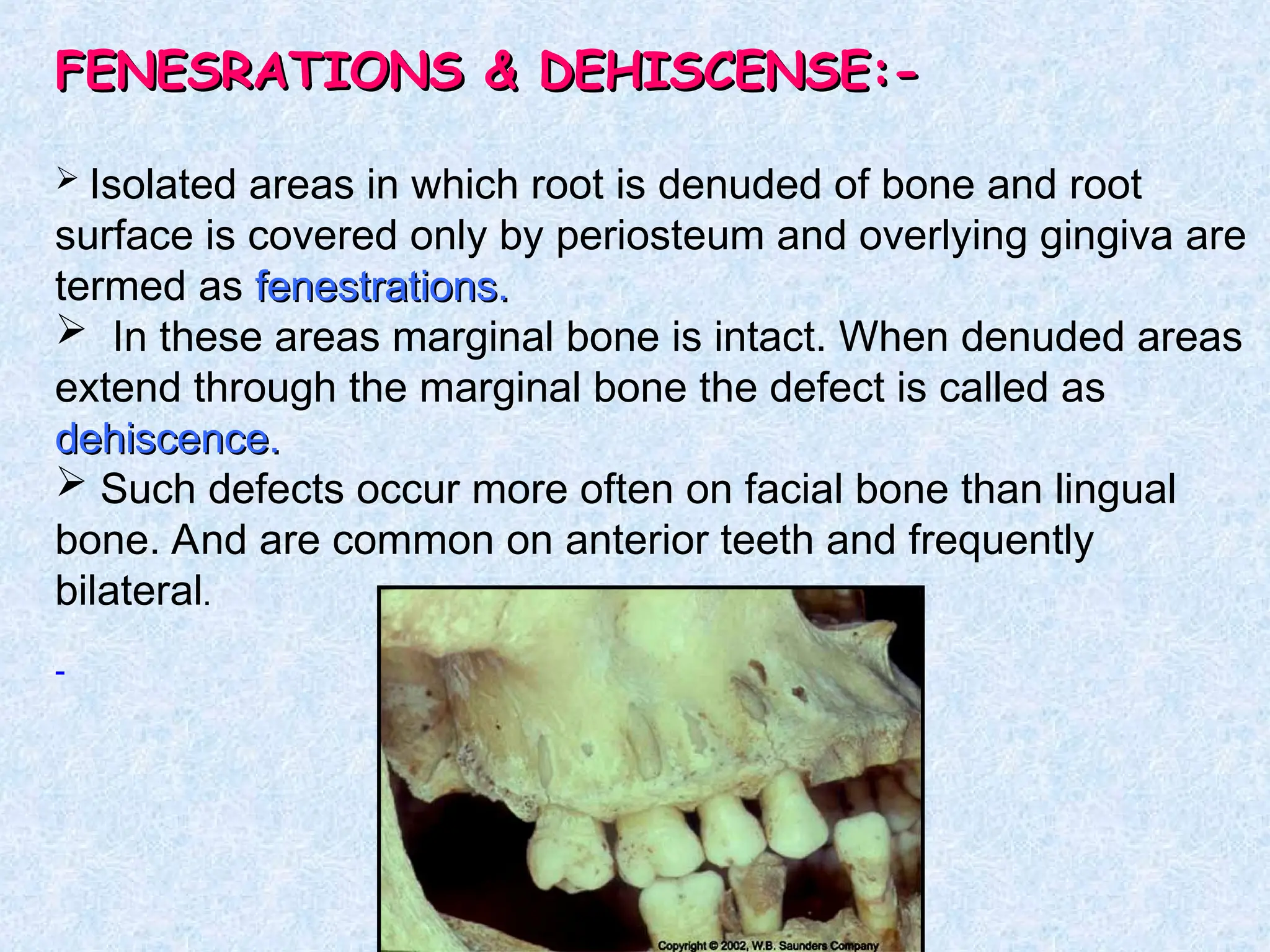 4 ALVEOLAR BONE in periodontology final.ppt