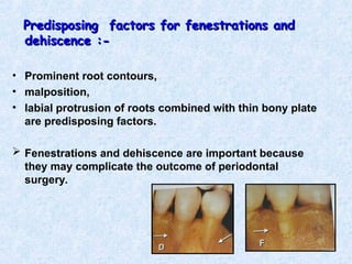 4 ALVEOLAR BONE in periodontology final.ppt