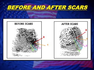 Scarred Patterns | PPT