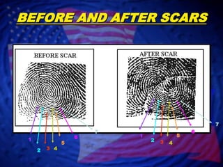 Scarred Patterns | PPT