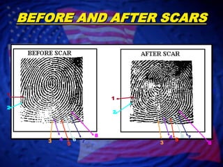 Scarred Patterns | PPT