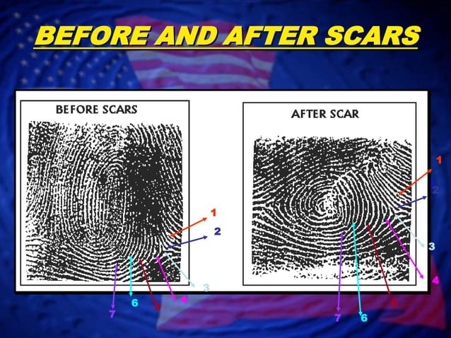 Scarred Patterns | PPT